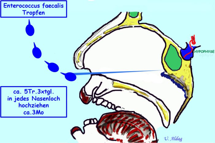 Ein Hoch der Abwehr! - Institut für Neuraltherapie