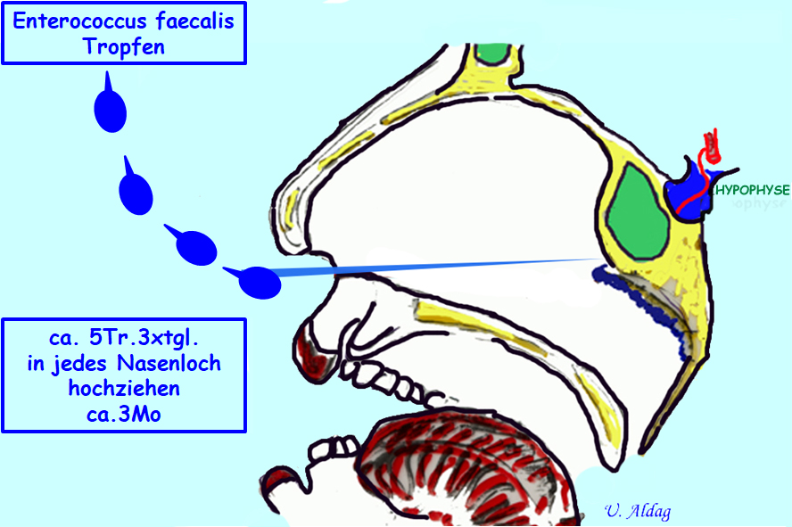 Ein Hoch der Abwehr! - Institut für Neuraltherapie