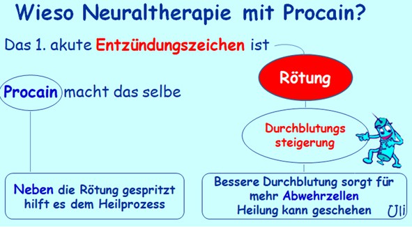 Durchblutungsverbesserung ist eine Procainleistung - Institut für ...